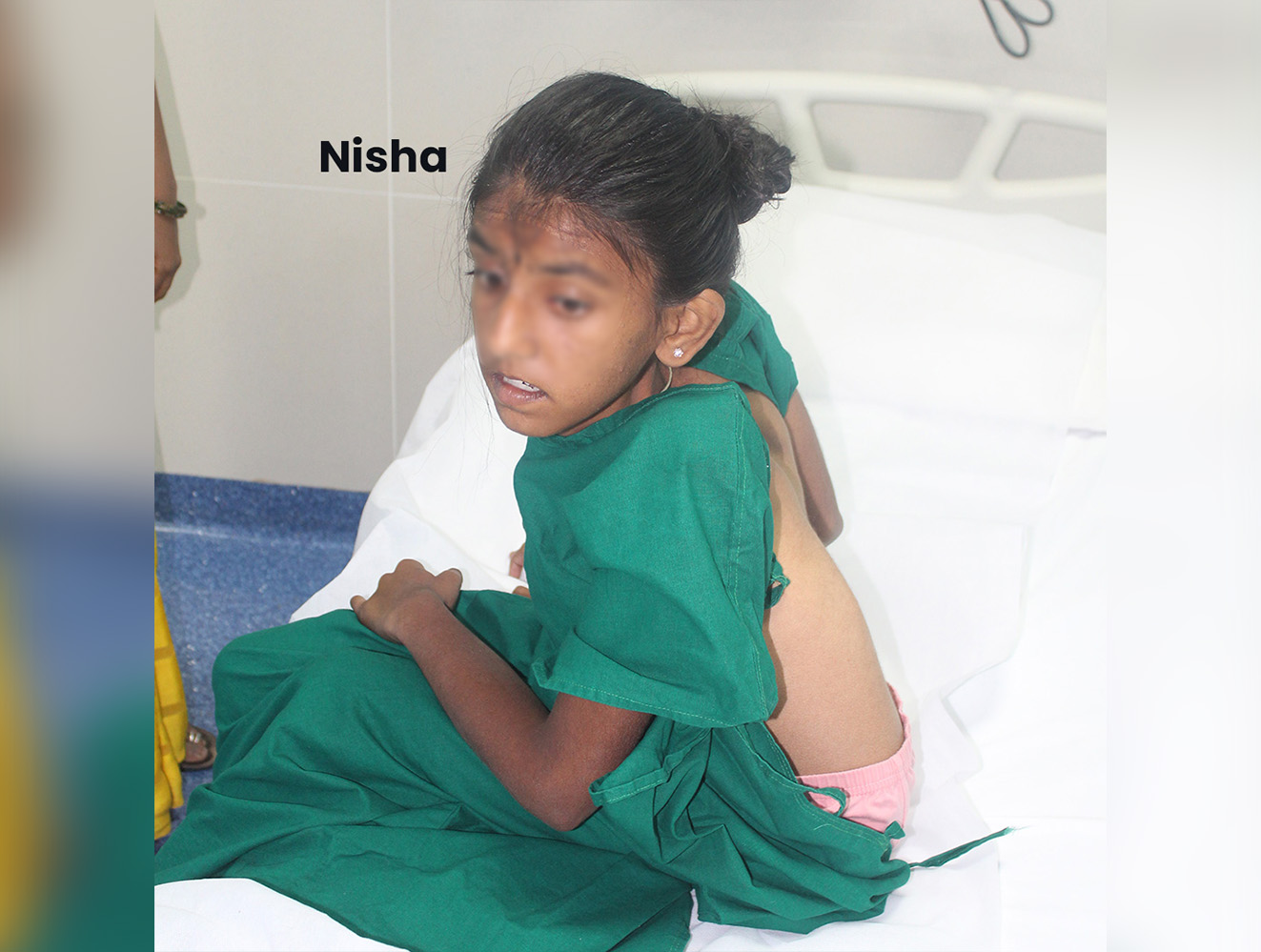 Sisters in Distress, Please Help Nisha & Nidhi Fight Scoliosis